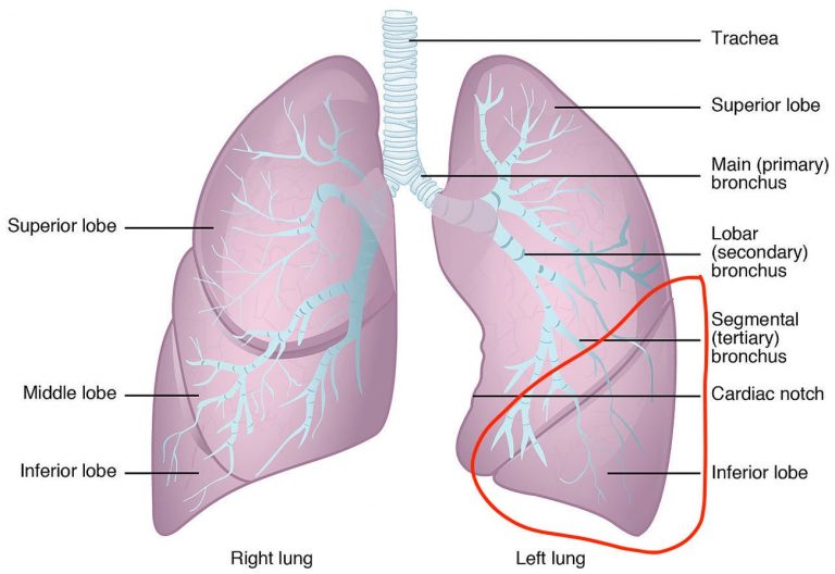 Lung Lobectomy: What you need to know – The Operating Room Global (TORG ...